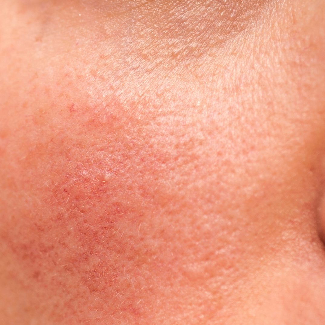 Clinical Dermatology - South Florida Dermatology